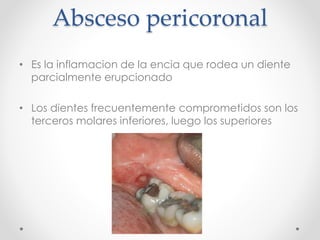 clasificacion de las enfermedades periodontales | PPTX
