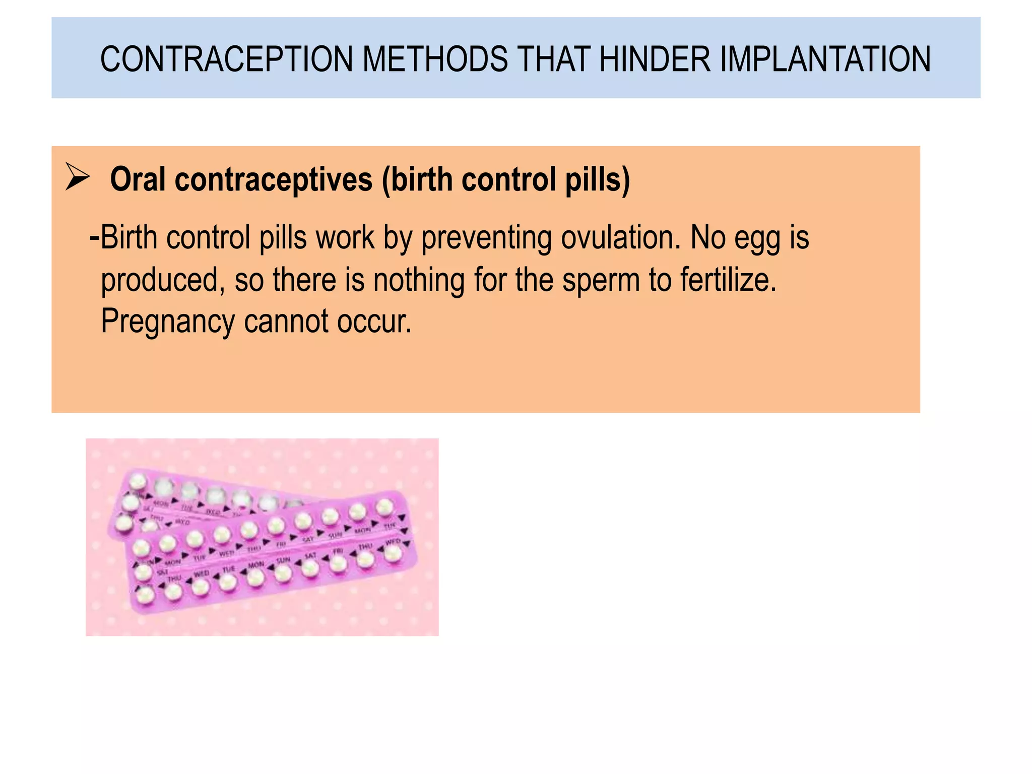 Preventing implantation-of-fertilized-egg | PPTX