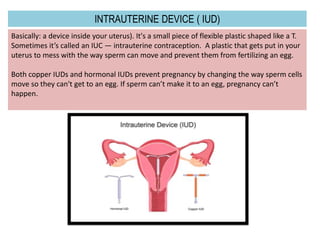 Preventing implantation-of-fertilized-egg | PPTX