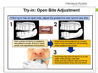Preventing anterior open bites final | PDF