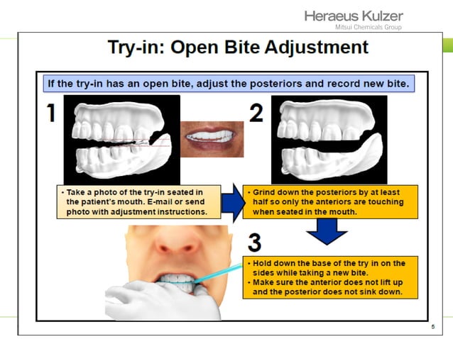 Preventing anterior open bites final | PDF