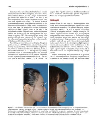 Preventing elevated radix deformity in asian | PDF