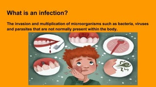 Preventing infection | PPTX