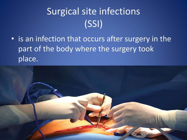 Preventing infection in Operating Theater | PPTX