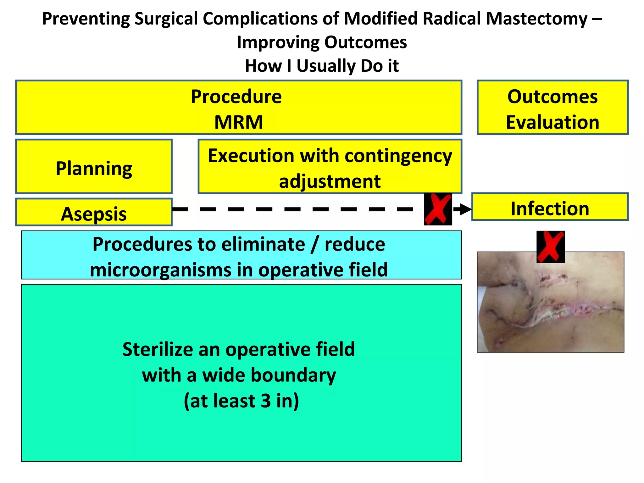Preventing Surgical Complications of Modified Radical Mastectomy | PPT