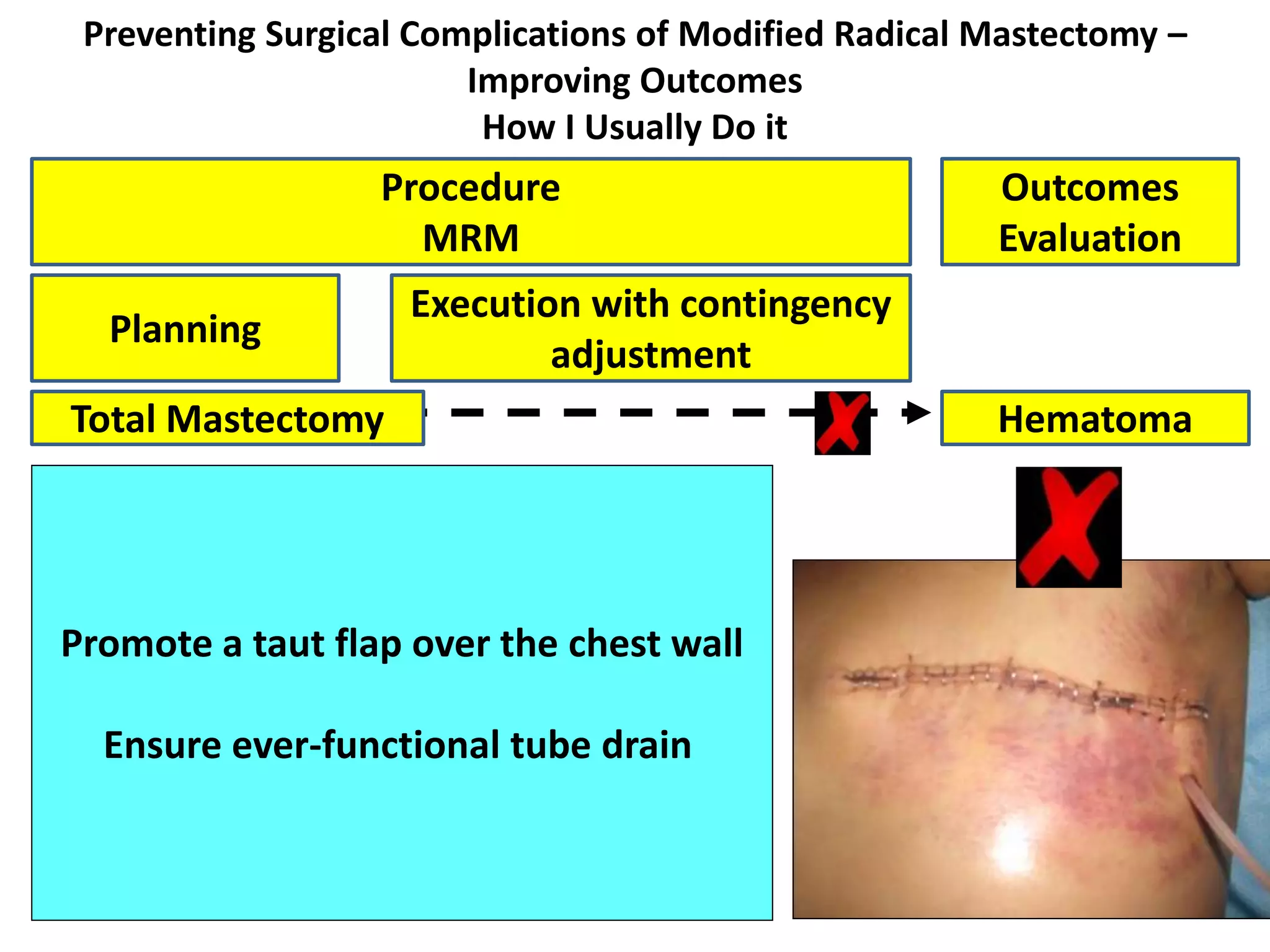 Preventing Surgical Complications of Modified Radical Mastectomy ...