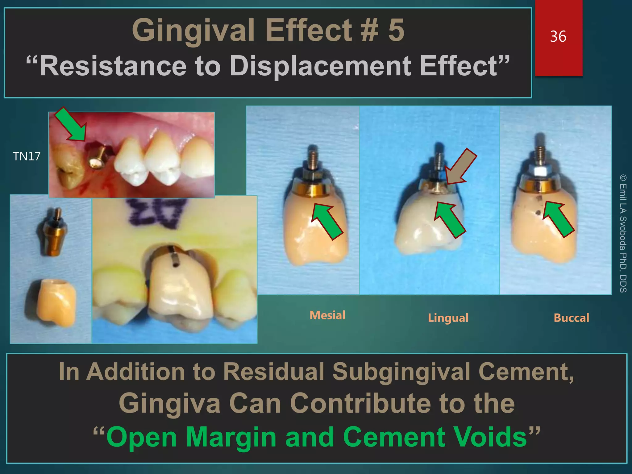 Preventing Peri-implantitis by Safer Prosthesis Installation | PPT