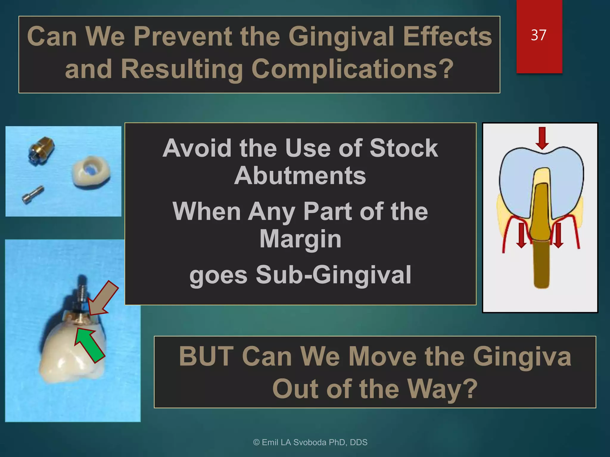 Preventing Peri-implantitis by Safer Prosthesis Installation | PPT