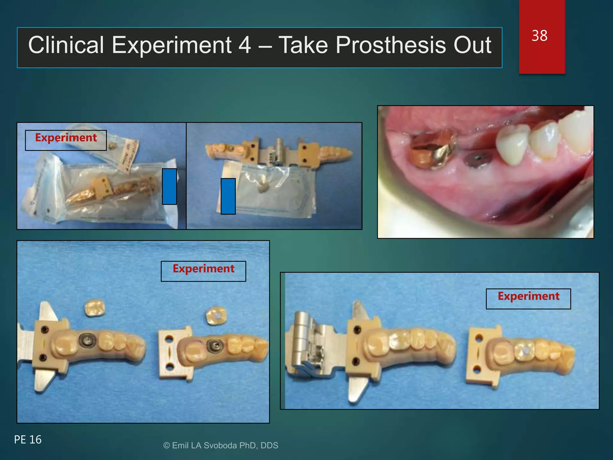 Preventing Peri-implantitis by Safer Prosthesis Installation | PPT