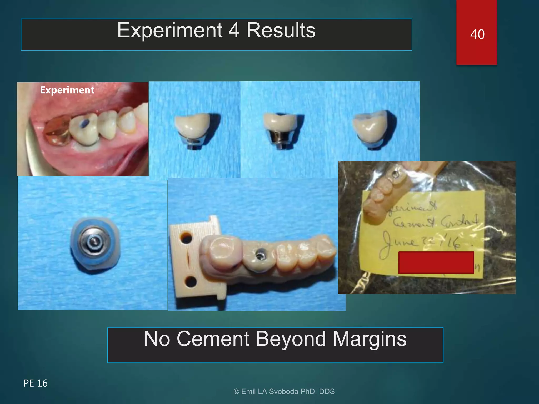 Preventing Peri-implantitis by Safer Prosthesis Installation | PPT