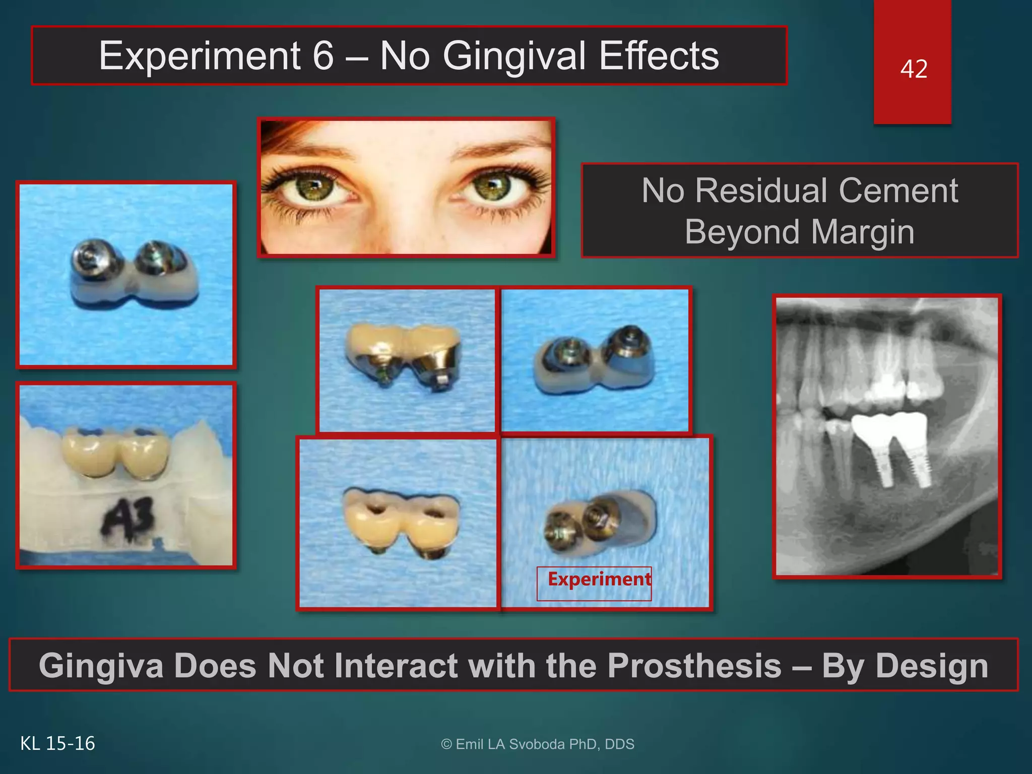 Preventing Peri-implantitis by Safer Prosthesis Installation | PPT