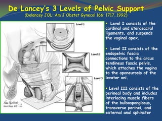 Preventing vault prolapse after hysterectomy | PDF
