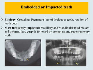 prevention.ppt | Dental Health | Diseases and Conditions
