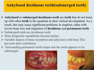 prevention.ppt | Dental Health | Diseases and Conditions