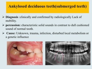 prevention.ppt | Dental Health | Diseases and Conditions