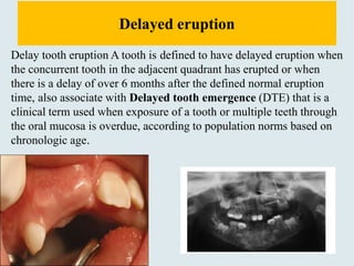 prevention.ppt | Dental Health | Diseases and Conditions