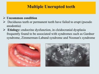 prevention.ppt | Dental Health | Diseases and Conditions