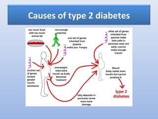 Prevention of type 2 diabetes | PPT