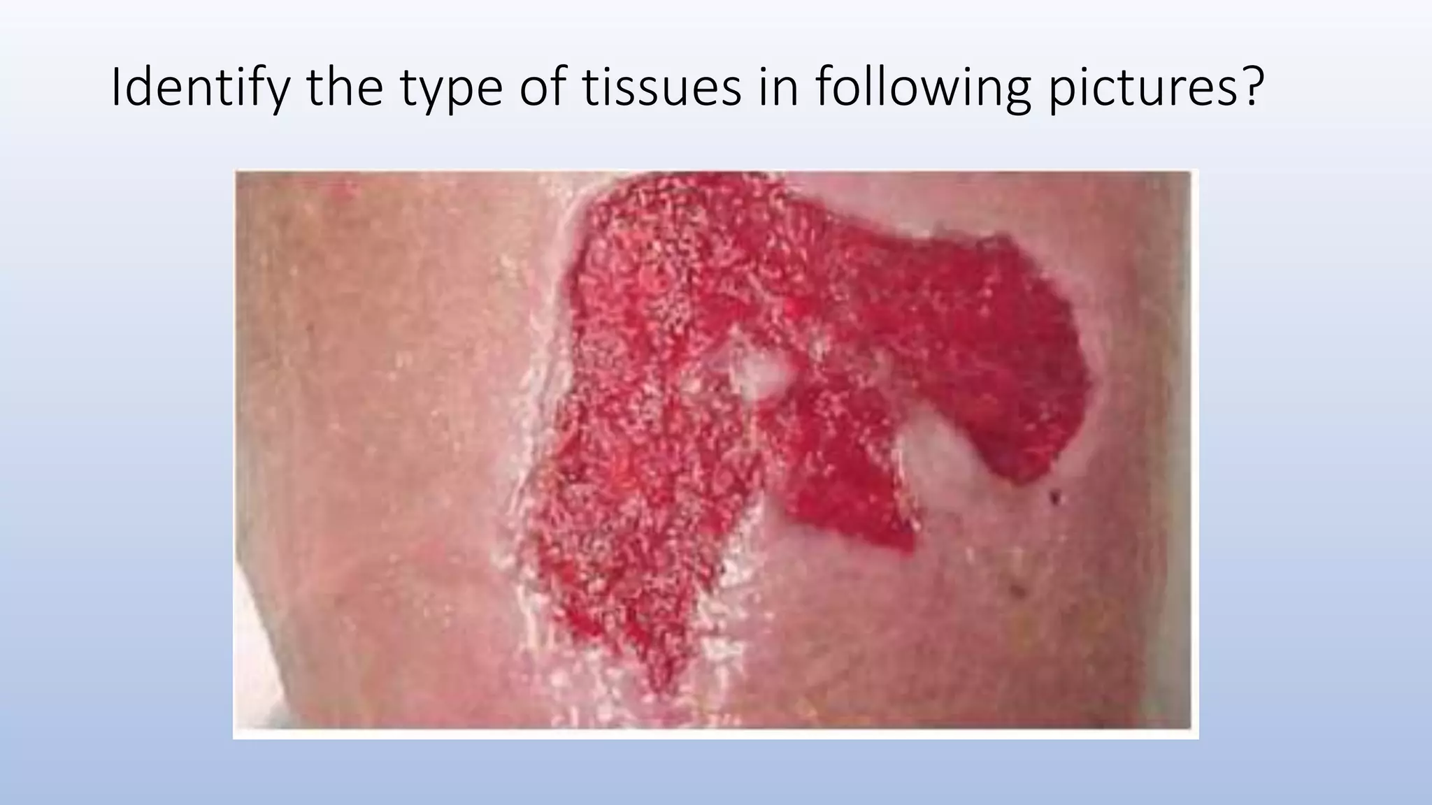 Prevention and management of pressure injury | PPTX