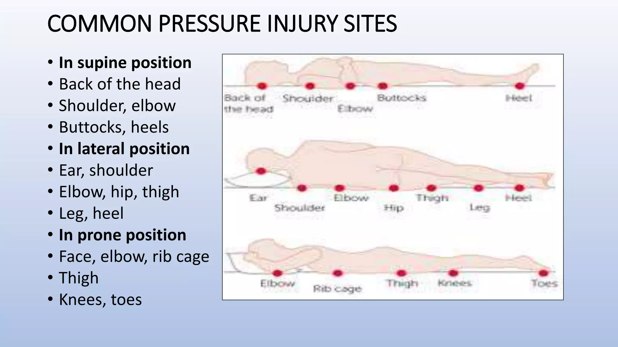 Prevention and management of pressure injury | PPTX