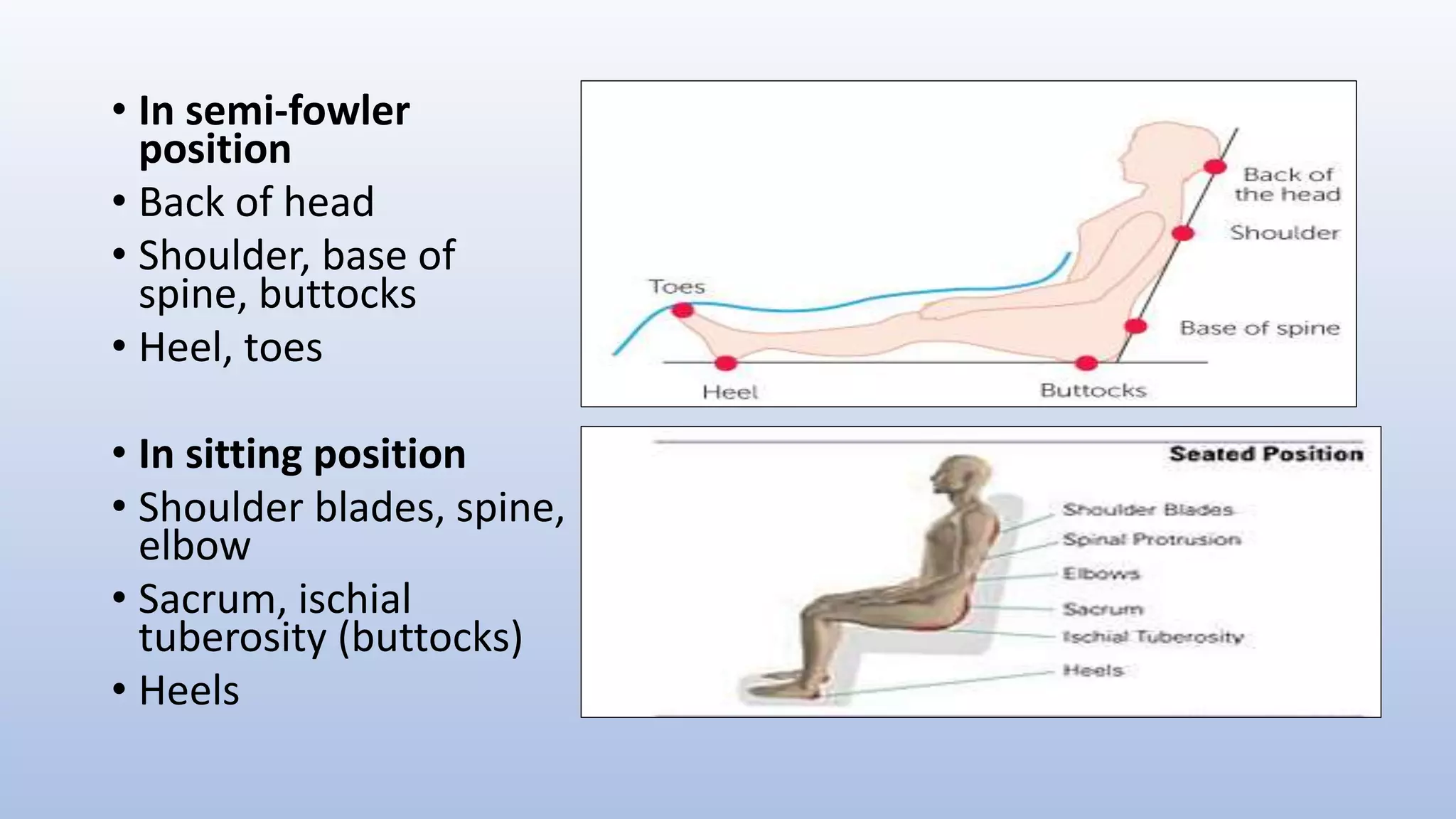Prevention and management of pressure injury | PPTX
