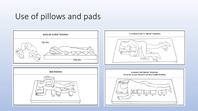Prevention and management of pressure injury | PPTX