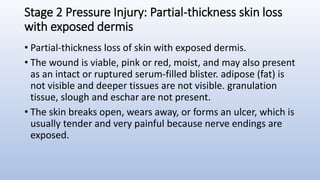 Prevention and management of pressure injury | PPTX