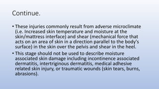 Prevention and management of pressure injury | PPTX
