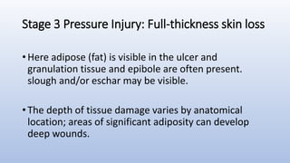 Prevention and management of pressure injury | PPTX