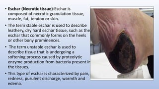 Prevention and management of pressure injury | PPTX