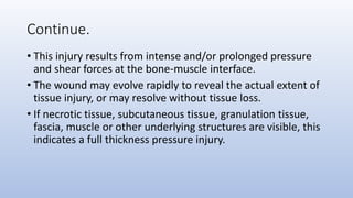 Prevention and management of pressure injury | PPTX