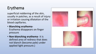 Prevention and management of pressure injury | PPT