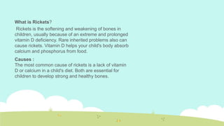 Prevention and Treatment of Rickets in children.pptx