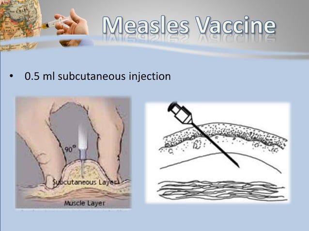 Prevention & control of exanthematous fever | PPT