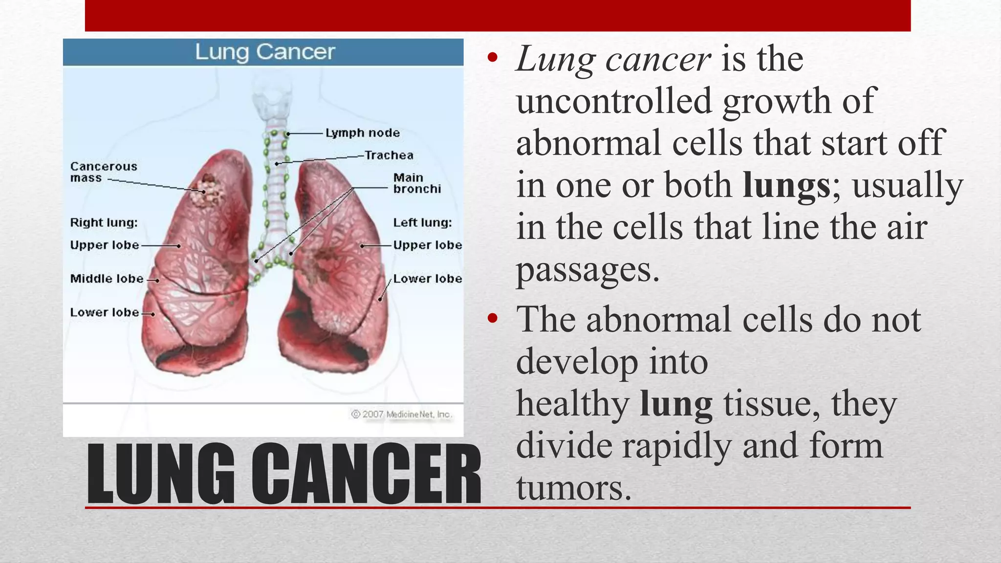 PREVENTION, DETECTION AND TREATMENT OF DISEASES OF THE RESPIRATORY ...