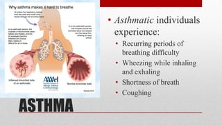 PREVENTION, DETECTION AND TREATMENT OF DISEASES OF THE RESPIRATORY ...