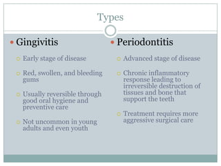 Difference Between Gingivitis And Periodontitis