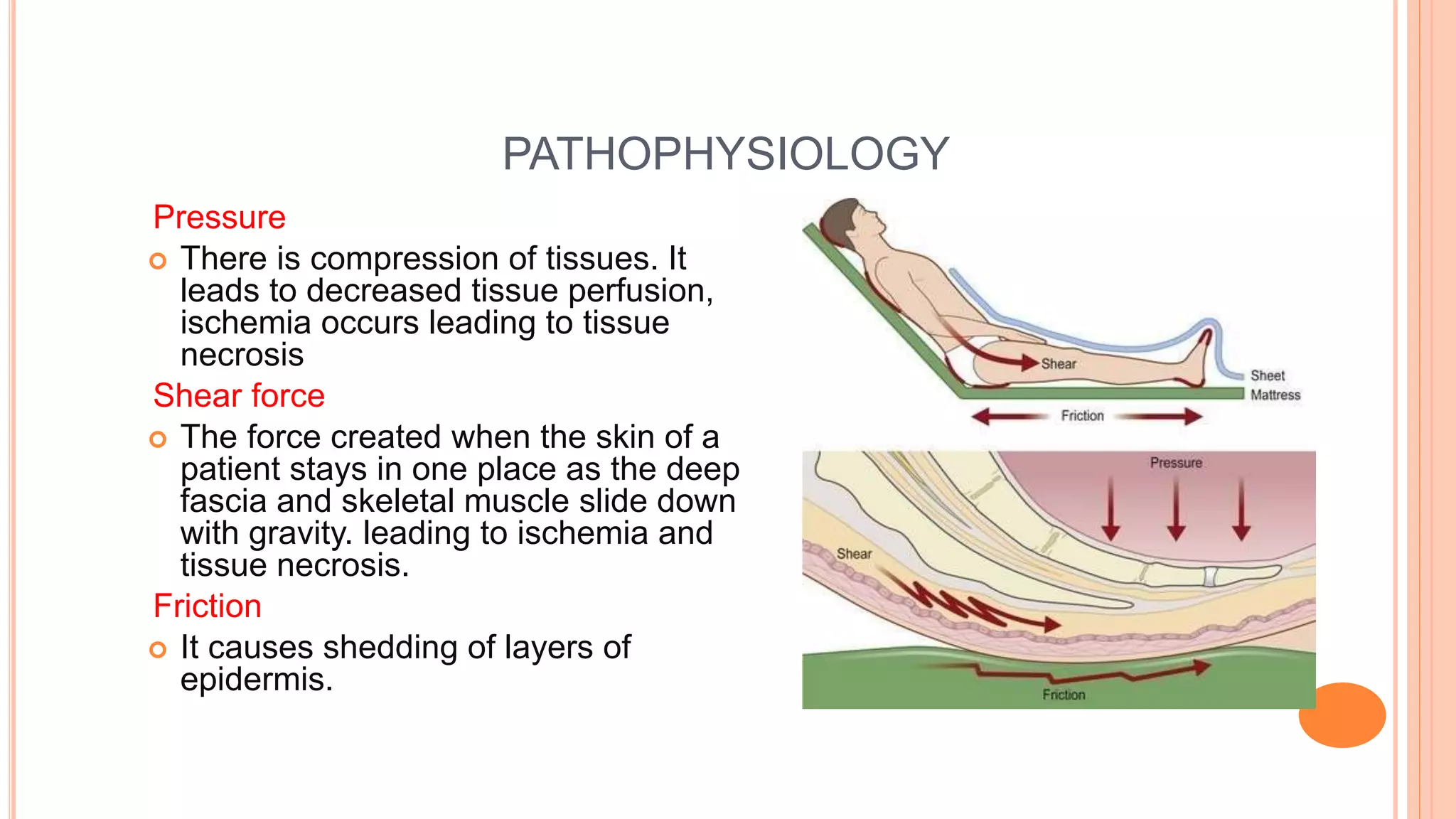 Prevention of Bed Sore Injuries in ICU patients.pptx