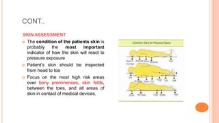 Prevention of Bed Sore Injuries in ICU patients.pptx