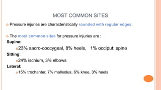 Prevention of Bed Sore Injuries in ICU patients.pptx