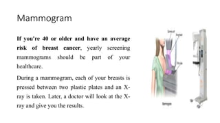 Prevention of breast cancer (3) | PPTX