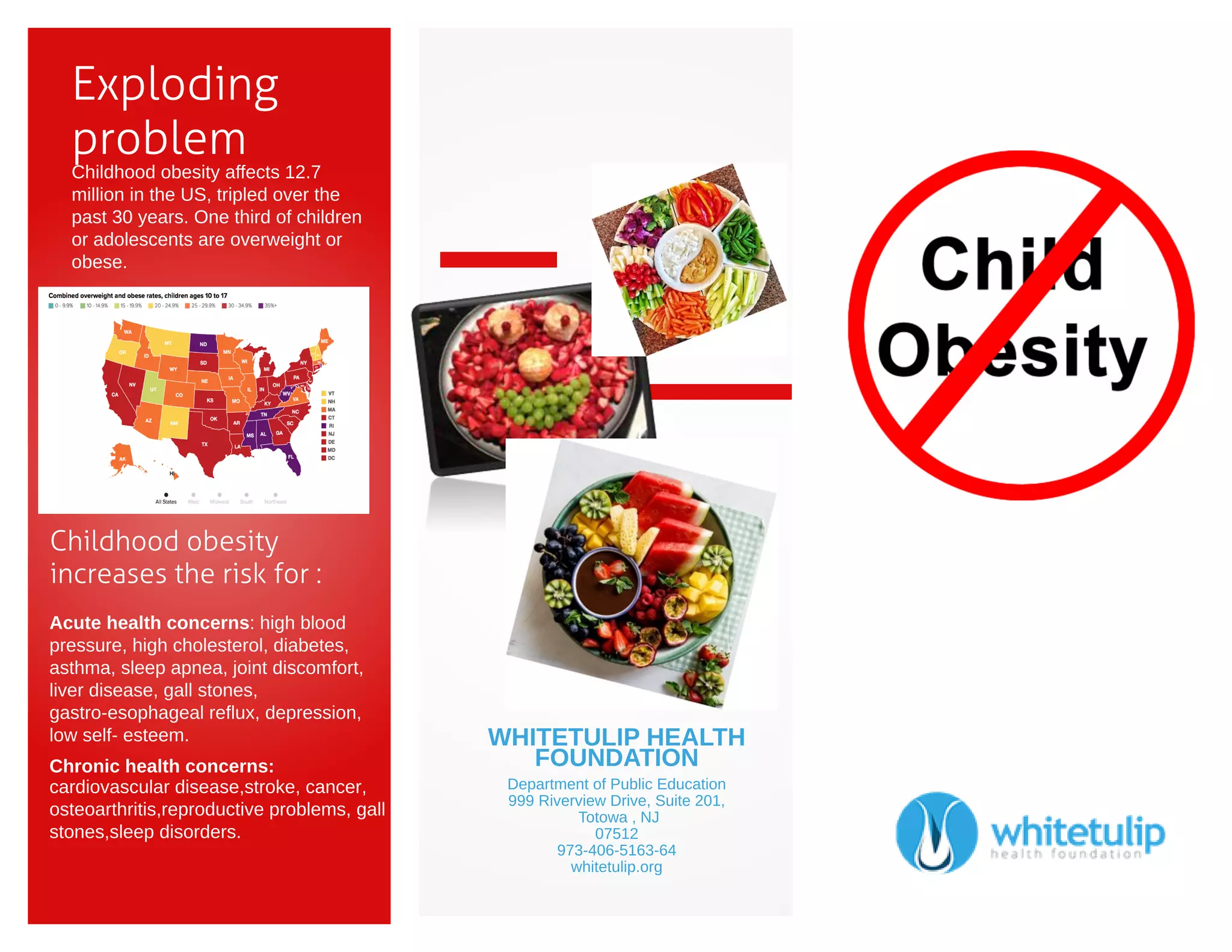 Prevention of Childhood Obesity | PDF