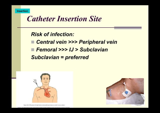Prevention of Central Line Associated Blood Stream Infection (CLABSI ...