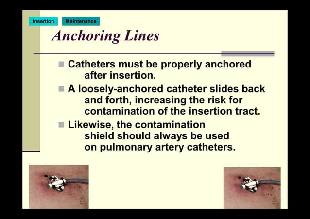 Prevention of Central Line Associated Blood Stream Infection (CLABSI ...
