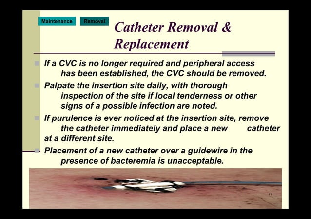 Prevention of Central Line Associated Blood Stream Infection (CLABSI ...