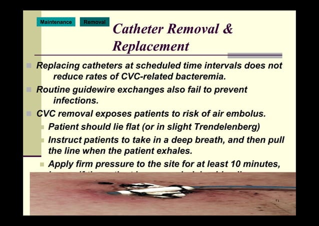 Prevention of Central Line Associated Blood Stream Infection (CLABSI ...