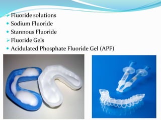 Prevention of dental caries | PPTX