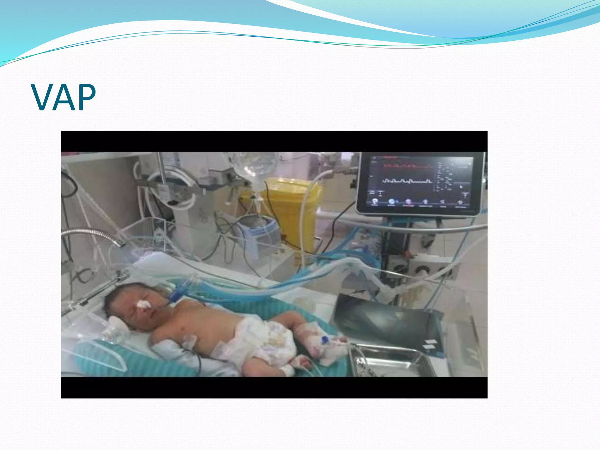 Prevention of infection in nicu | PPTX