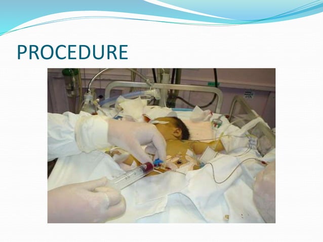 Prevention of infection in nicu | PPTX