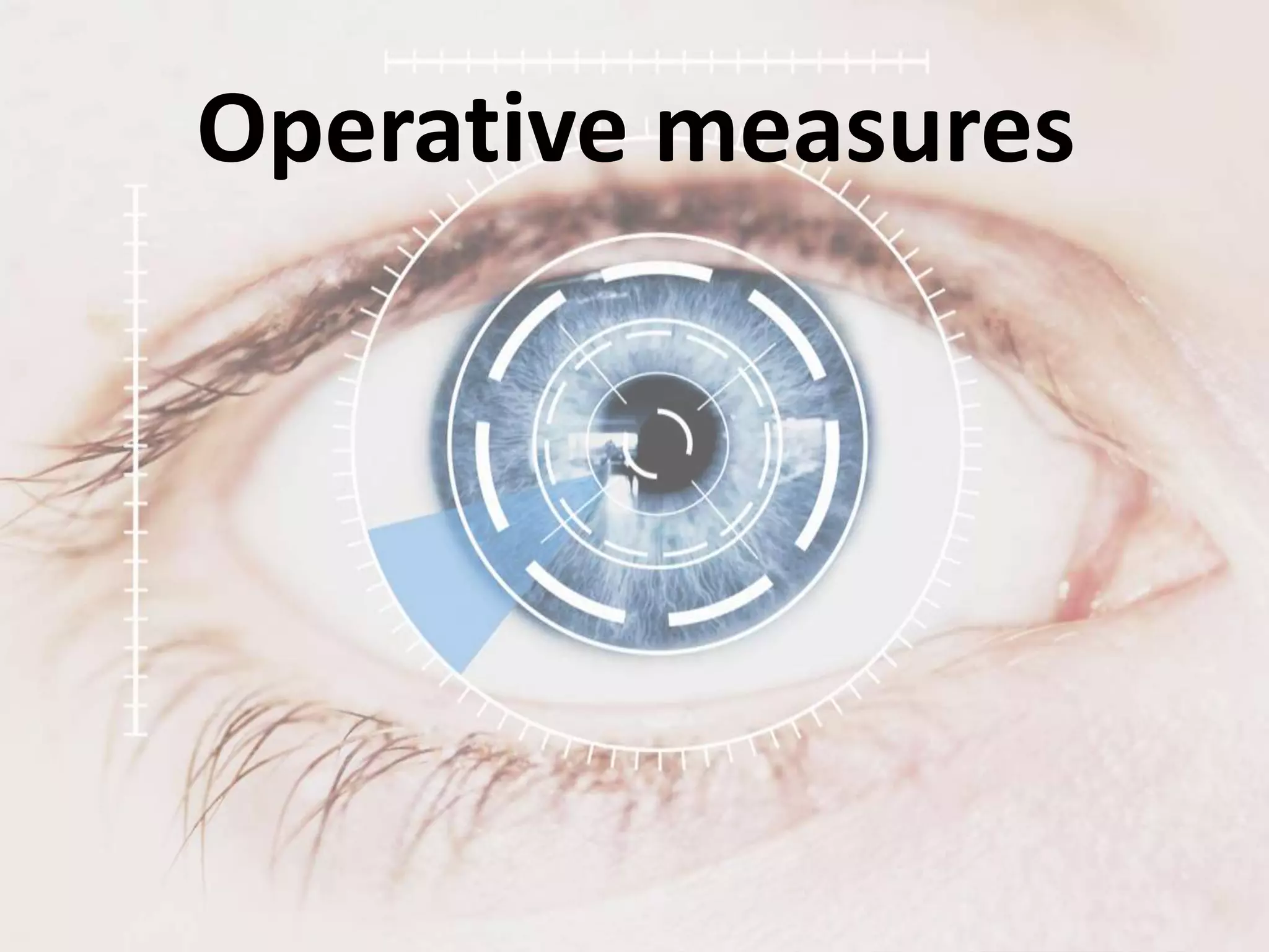 Prevention of Intraocular Infection in Pre-op and Post-op Ocular ...